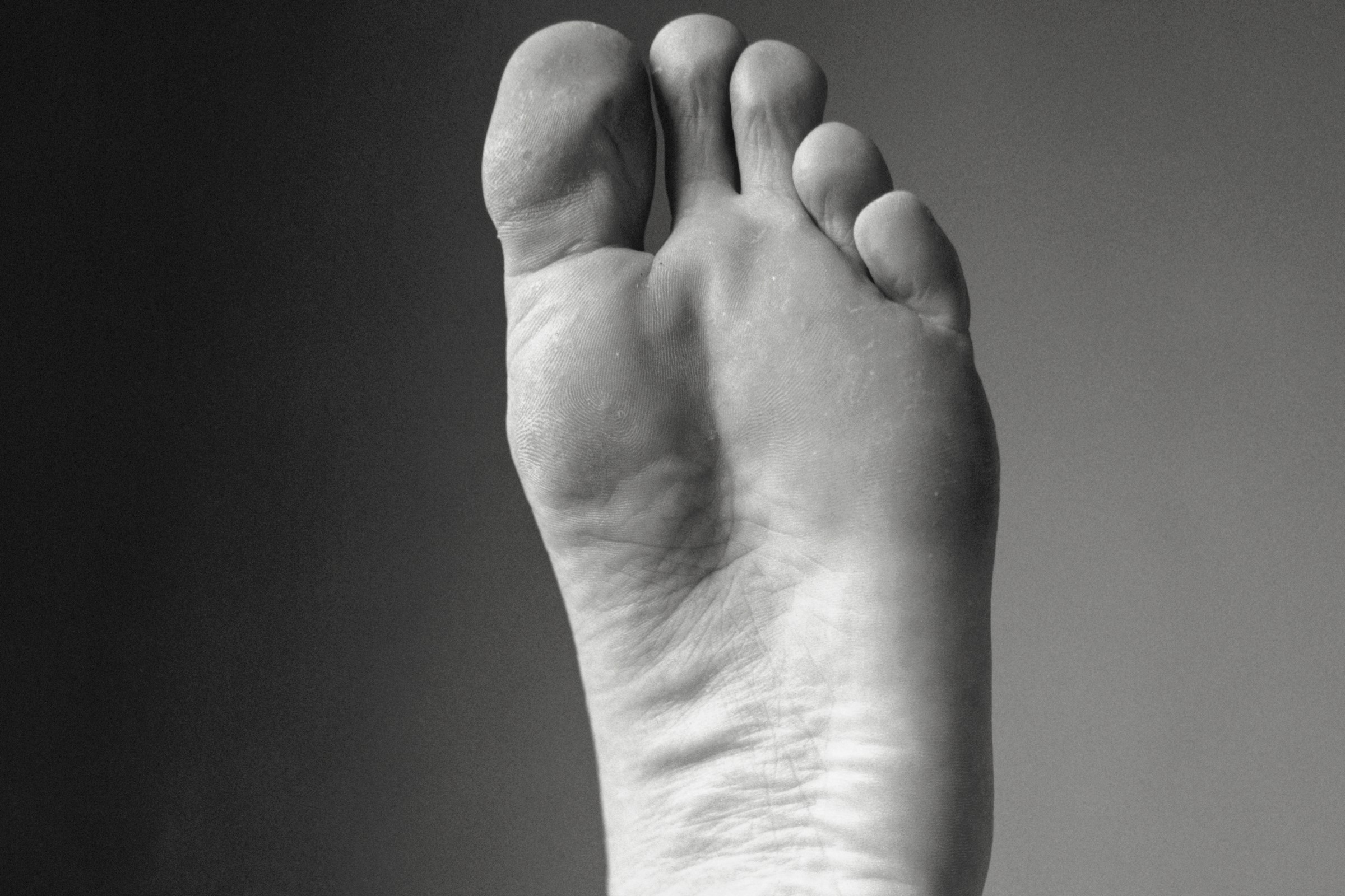 Urinsyregikt – podagra - Helsenorge