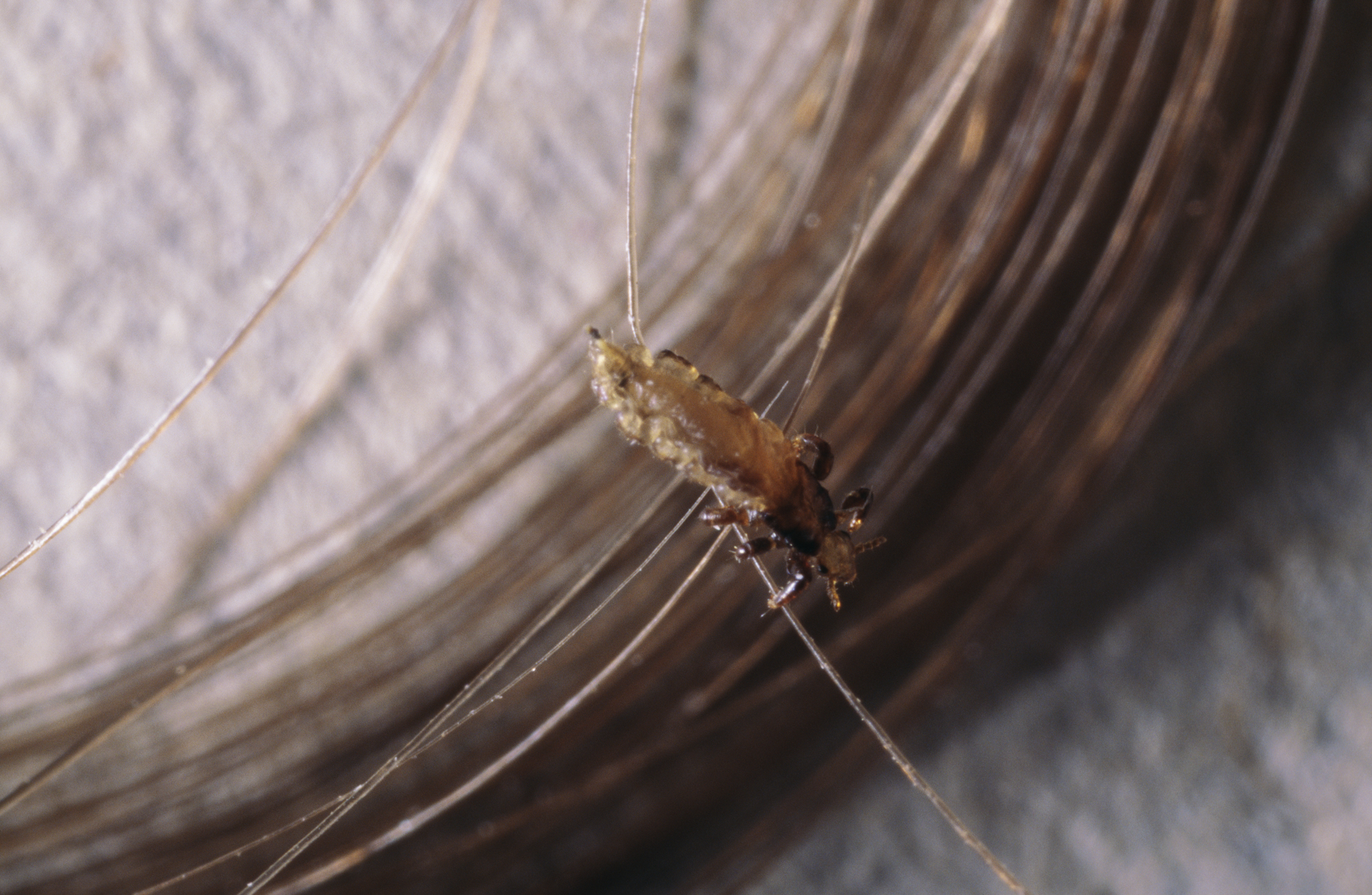 What Causes Lice In Hair